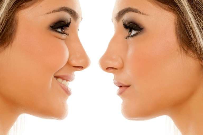 Welche Bedeutung haben Nasenformen?